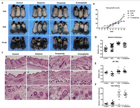 Testosterone Propionate Induced Androgenetic Alopecia Aga Model Creative Bioarray Creative