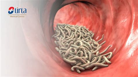 Napza Jenis Jenis Gejala Pemeriksaan And Bahayanya