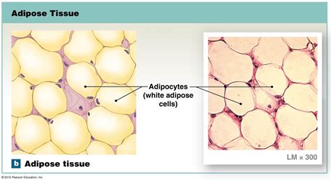 Adipose Corpse