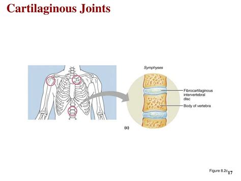 Ppt Classification And Structure Of Joints In The Skeleton Powerpoint