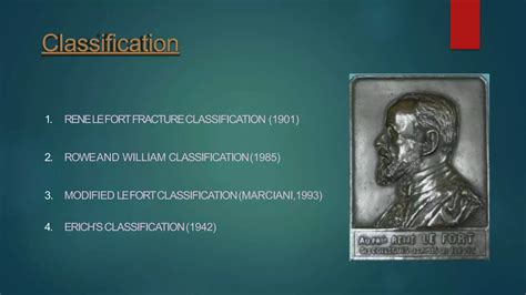 Midface Fractures Pptx