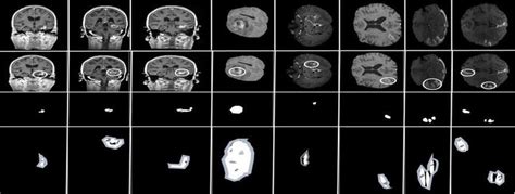 the first row shows the mri images the second row the third row are