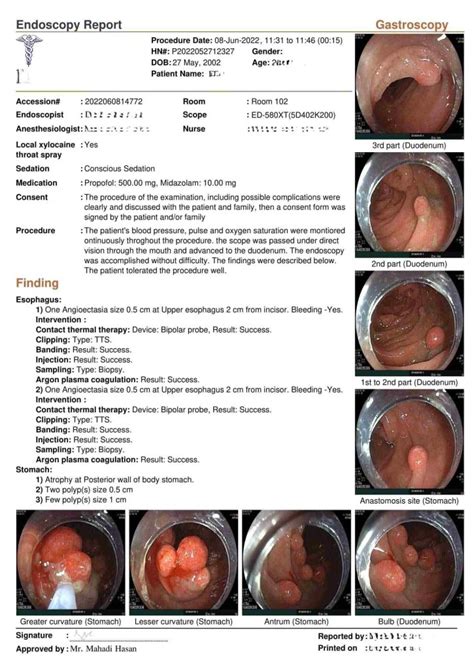 What To Expect From A Normal Endoscopy Report