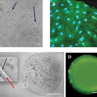 Recognition Of Choroid Plexus Epithelial Cells CPECs And Image Of The Download Scientific