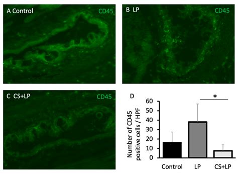 Conjunctival Cd45 Immunohistochemistry Staining And Cd45 Positive Download Scientific Diagram