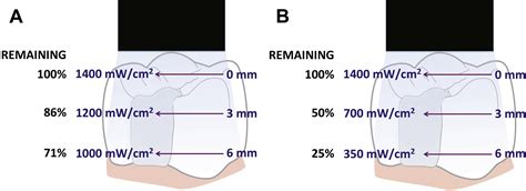Light Curing In Dentistry Dental Clinics