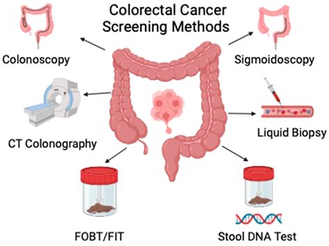 Rectal Cancer Diagram Bowel Colon Cancer Causes Symptoms