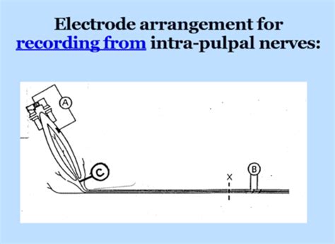 6 Dentine Sensitivity Physiology And Pathology Flashcards Quizlet