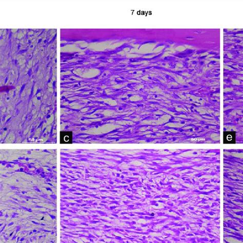 Histopathological Analysis Of Fibroblasts Using Hematoxylin And Eosin Download Scientific