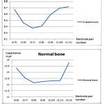 Modeling And Calibration Of Electrical Capacitance Tomography Sensor For Medical Imaging