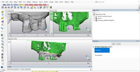 Creating 3 D Model From Dicom Cbct Files Download Scientific Diagram