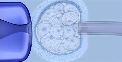 What Is PGT Genesis Fertility Reproductive Medicine