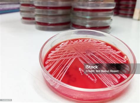 Pertumbuhan Sedang Agar Darah Streptococcus Staphylococcus Aureus Bakteri Gram Positif Di