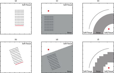 Figure 1 From Accurate Simulation Of Transcranial Ultrasound Propagation For Ultrasonic