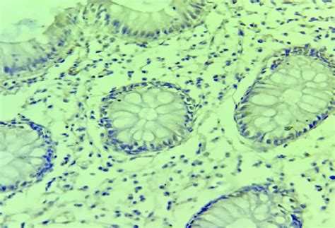 Adenomatous Polyp Negative For Pik3ca Compound Microscope 40x Download Scientific Diagram