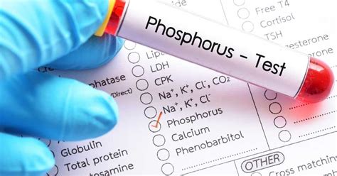 Phosphorus Labcorp Test Code At Edward Gratwick Blog Phosphorus Labcorp Test Code At Edward Gratwick Blog