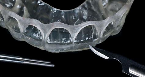 Moomen Osama On Linkedin Lets Surgery 👌🏻 Gingivectomy Guide Ds6ggxjk