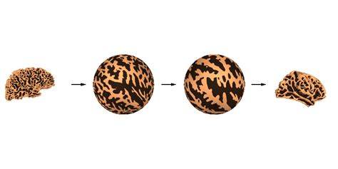 How Mne Uses Freesurfers Outputs — Mne 1101 Documentation