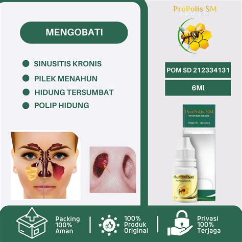 Obat Sinusitis Pilek Menahun Polip Hidung Rhinitis Alergi Hidung Berbau