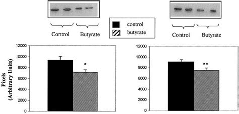 Microsomal Triglyceride Transfer Protein Mtp Protein Expression In Download Scientific