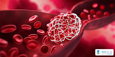 لخته شدن خون علائم و نشانه‌هایی که باید مراقبشان باشید