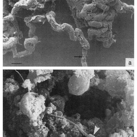 Scanning Electron Micrographs Of A Testicular Biopsy Following Download Scientific Diagram