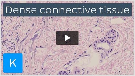 Dense Irregular Connective Tissue Diagram