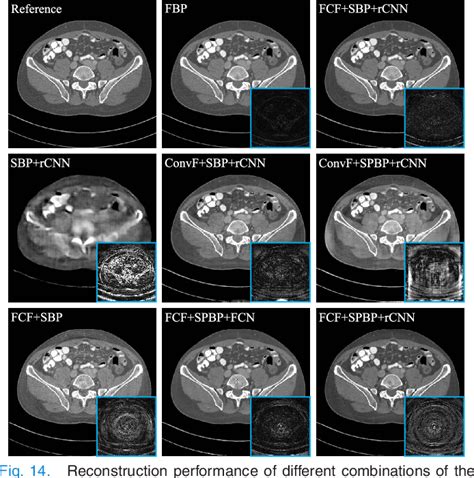 Figure 14 From Radon Inversion Via Deep Learning Semantic Scholar