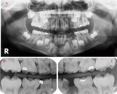 Journal Of Clinical Pediatric Dentistry Jocpd