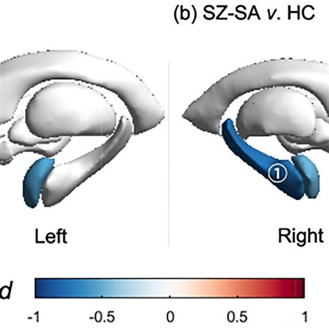 The Comparison Of Volumes Of Subcortical Structures Between Individuals Download Scientific