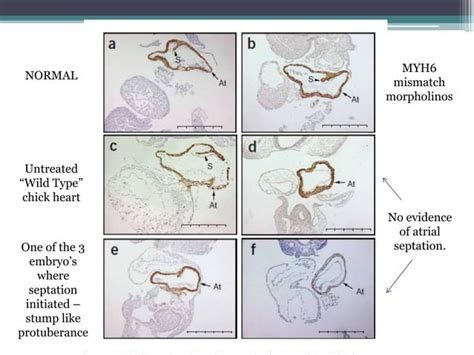 The Role Of Structural Proteins In Normal And Abnormal Heart