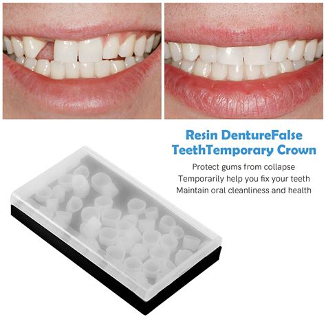Crown Other Medical Lab And Dental Supplies Temporary Dental Crowns