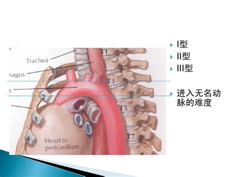 脑动脉解剖 Word文档在线阅读与下载 无忧文档