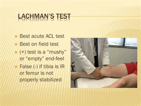 Ppt Knee Evaluations Powerpoint Presentation Free Download Id2139997