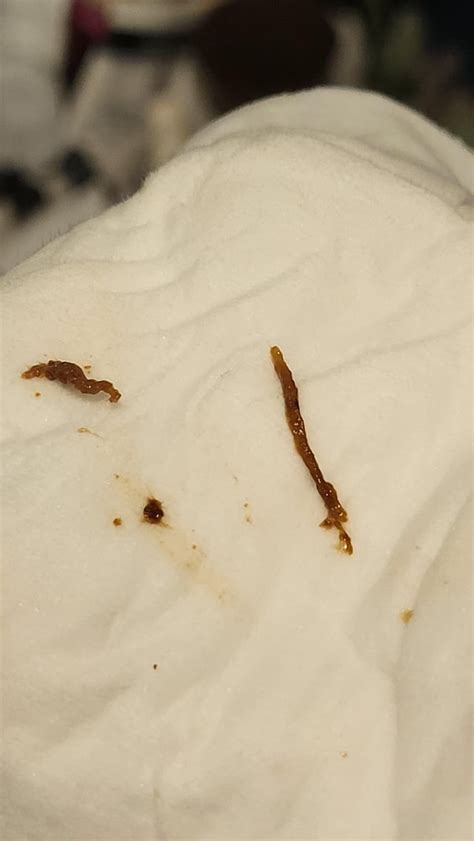 Please Are These Worms In Stool 🤢🤮😭 Rdiagnoseme