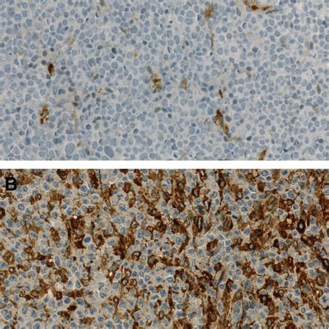 Fibronectin Staining Highlights Fibrous Strands Of The Ecm Between