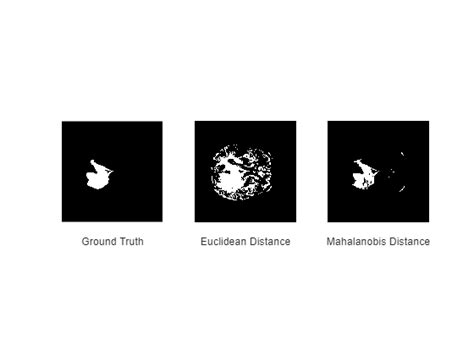 Brain Tumor Segmentation Using Fuzzy C Means Clustering Matlab And Simulink