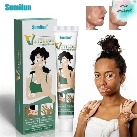 ⚫️ ЦЕНА 250 РУБ ⚫️ ⚜️ Мазь для лечения витилиго и белых пятен на основе трав 20 г ⚜️ ️ Основные