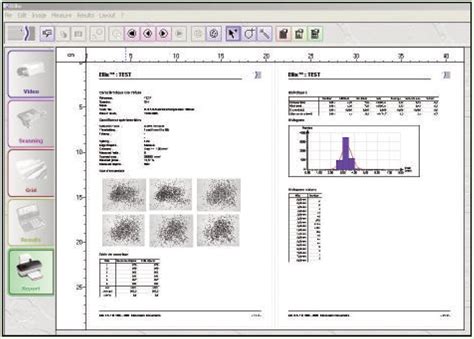 Image Analysis System For Fully Automatic Particle Counting And Sizing Non Motorised