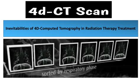 Inevitabilities Of 4d Computed Tomography In Radiation Therapy Treatment
