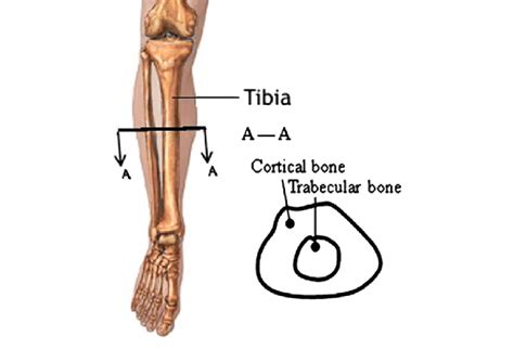 Tibia Bones