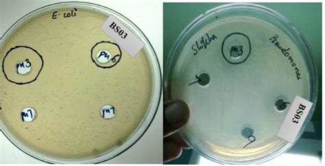 Isolation And Characterization Of Bacteriocin Producing Bacteria From