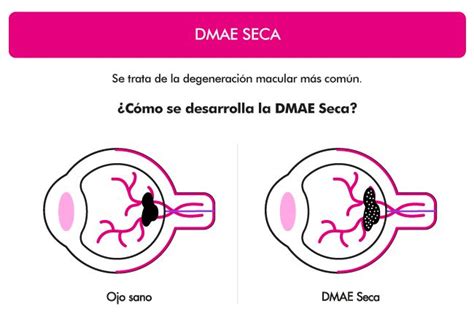 ¿Qué es? - Conecta Pacientes