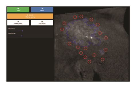 joint segmentation prototype user interface the user toggles the