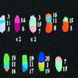 Breast Cancer Mutation Download Scientific Diagram