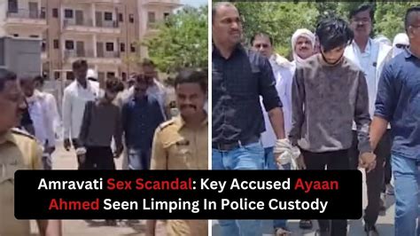 Amravati Sex Scandal Key Accused Ayaan Ahmed Seen Limping In Custody