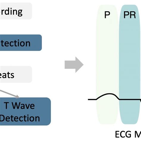 Diagram Of Ecg Measurement Based On Pattern Recognition Download