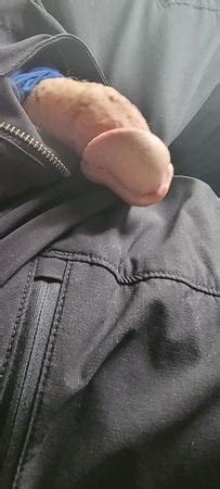 My Split Glans Pics Xhamster