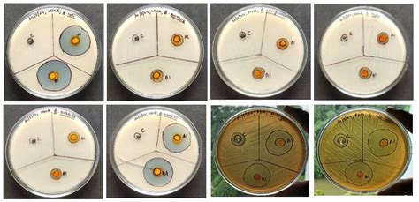 Formulation And Evaluation Of Turmeric And Neem Based Topical Nanoemulgel Against Microbial