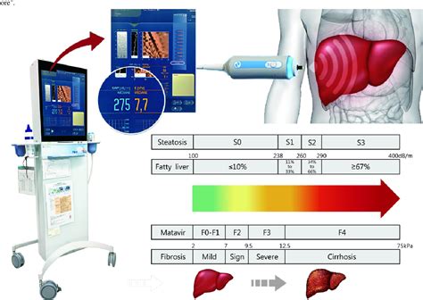 Figure 1 From Predicting Metabolic Syndrome With Machine Learning Models Using A Decision Tree